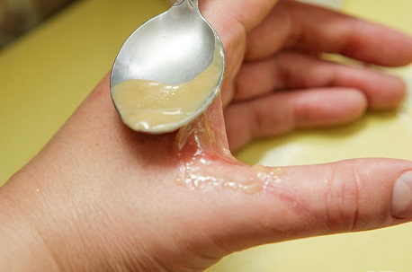 10 Easy Ways to Treat Burn Caused by Steam - EnkiVeryWell